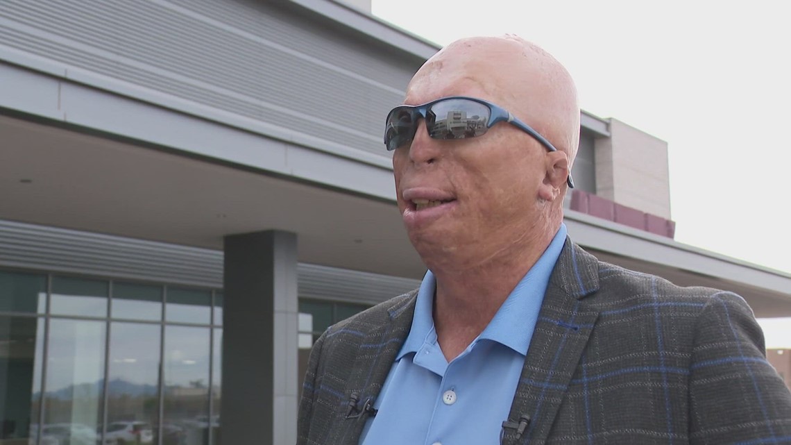 Jason Schechterle returns to burn center more than 20 years later ...