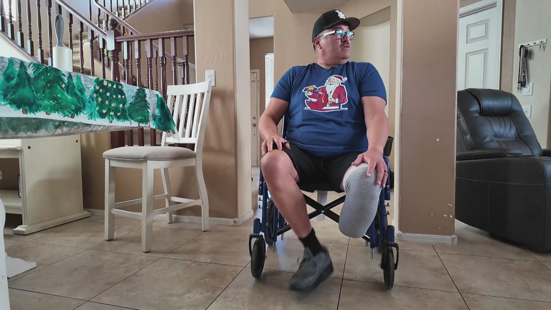 Arizona nurse loses leg after vacation in Florida | 12news.com