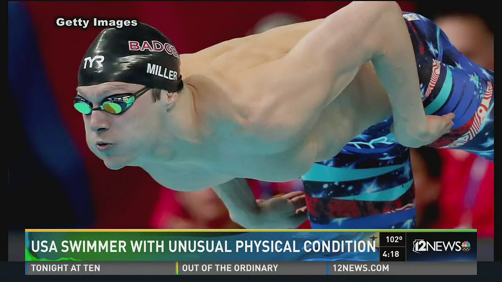 U.S. swimmer ignites interest in unusual chest condition | 12news.com