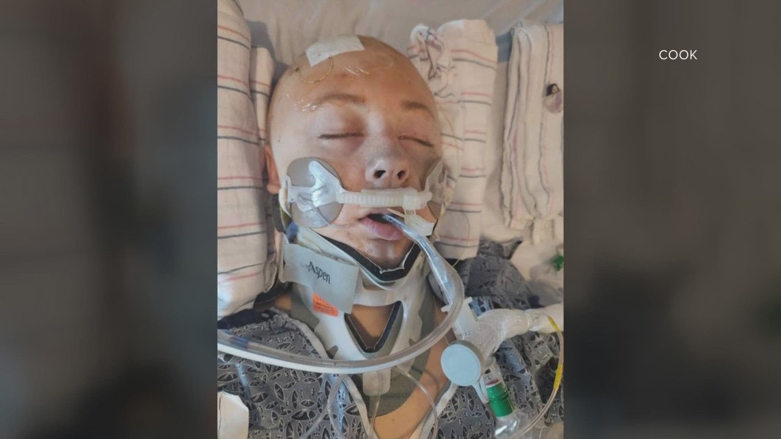 'I think kids think that they're invincible': Motorbike crash leaves ...