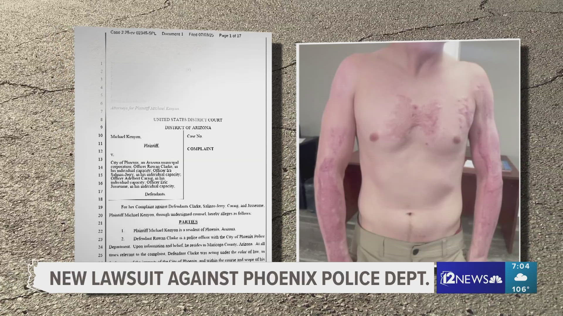 Lawsuit against Phoenix police officers, city claims excessive force ...