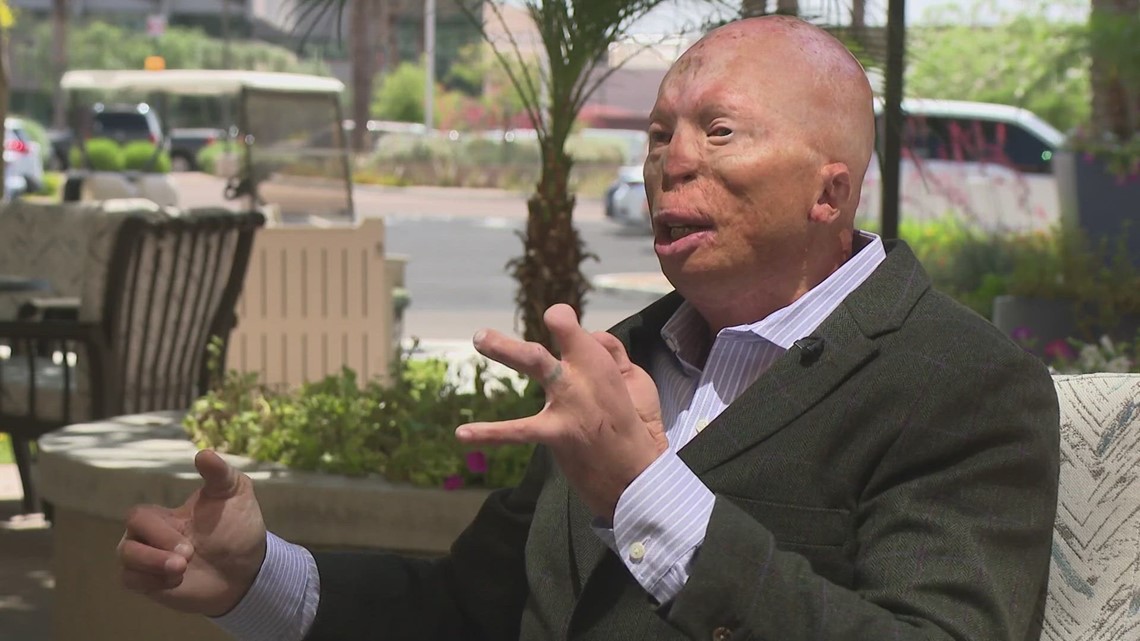 Former police officer shares resilient message, inspires hope | 12news.com