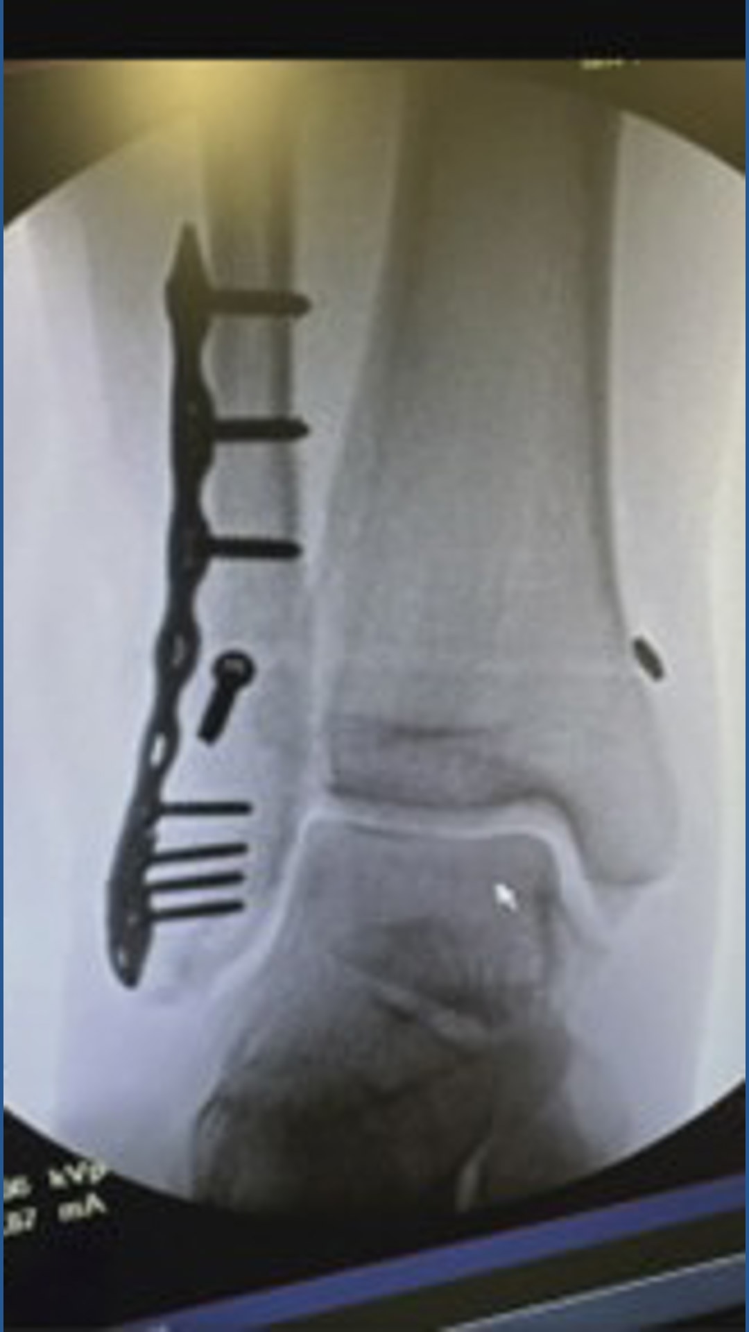 Former fan sues after serious injury at rowdy 2024 Waste Management ...