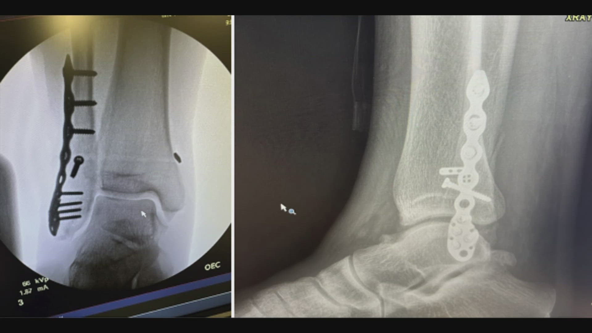 Former fan sues after serious injury at rowdy 2024 Waste Management ...