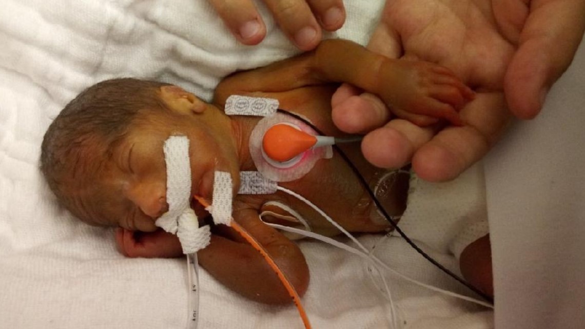 Family claims newborn burned by incubator at Phoenix hospital | 12news.com