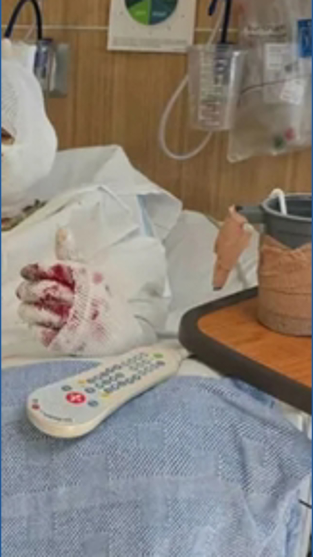 Prescott man suffers severe burns in gas line explosion | 12news.com