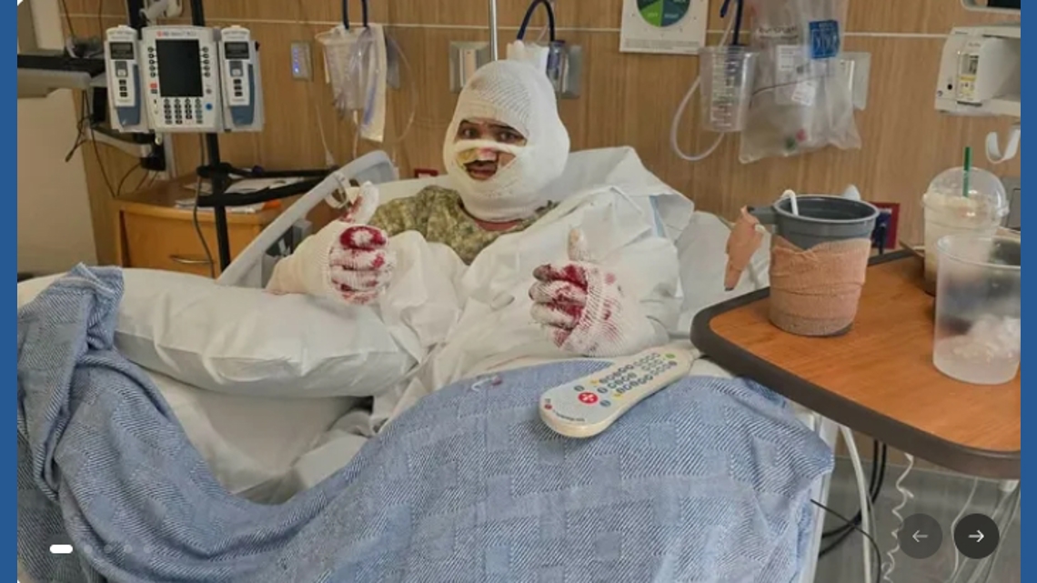 Prescott man suffers severe burns in gas line explosion | 12news.com