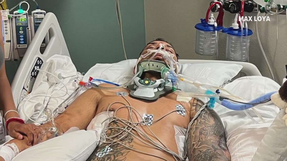 Valley dad lucky to be alive after motocross accident | 12news.com