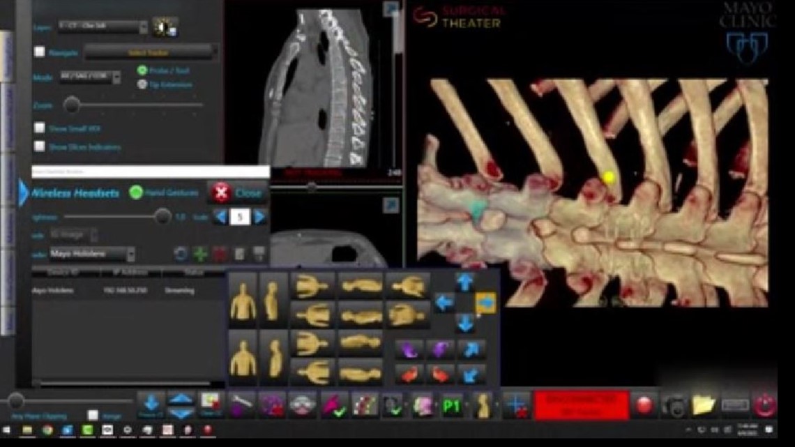 Mayo Clinic using augmented reality to help with surgeries | 12news.com