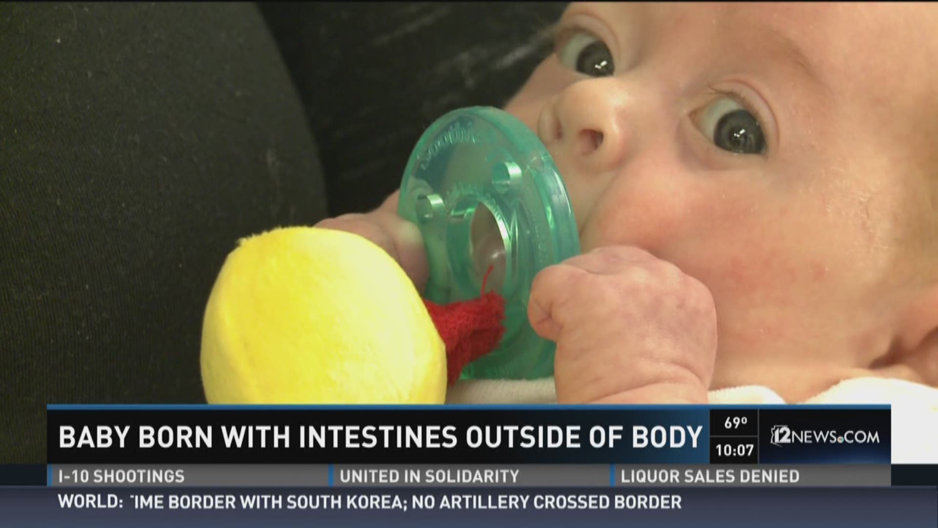 Phoenix baby girl born with her intestines on the outside of her body ...