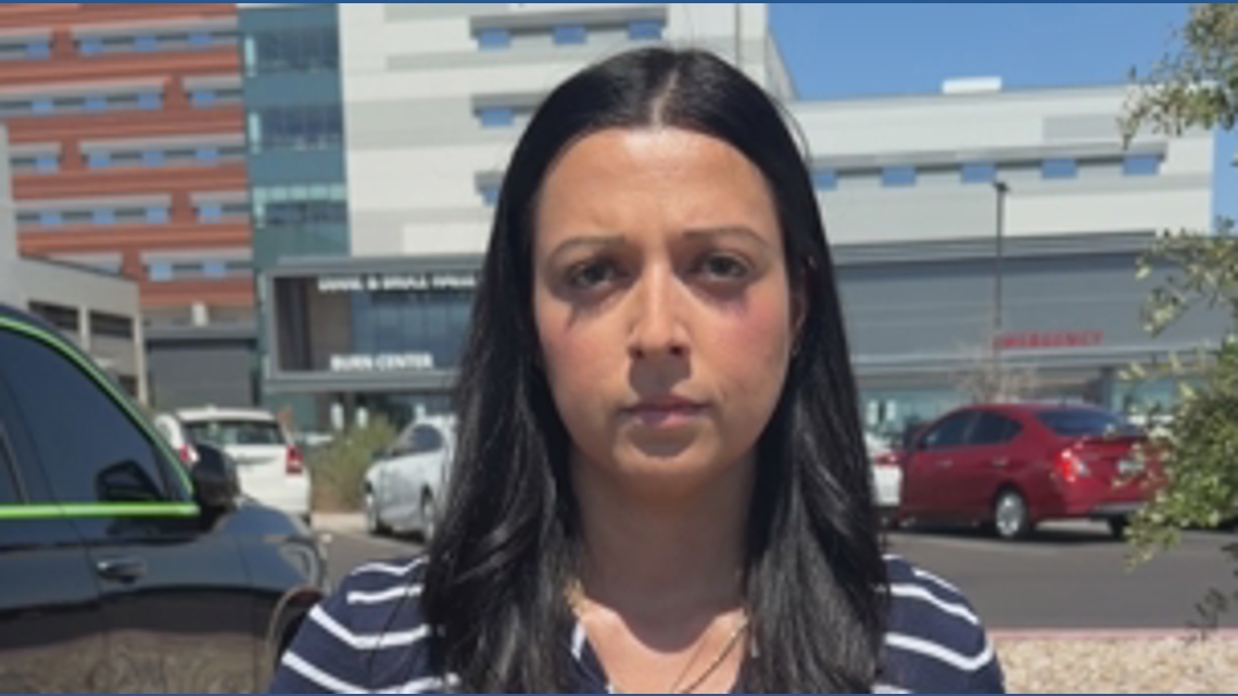 Woman fighting for life after falling asleep in sun | 12news.com