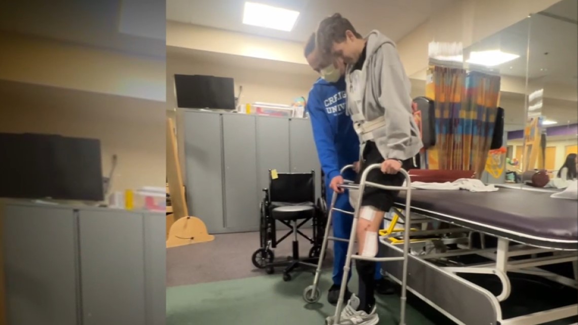 Teen who survived fatal I-17 crash loses leg | 12news.com