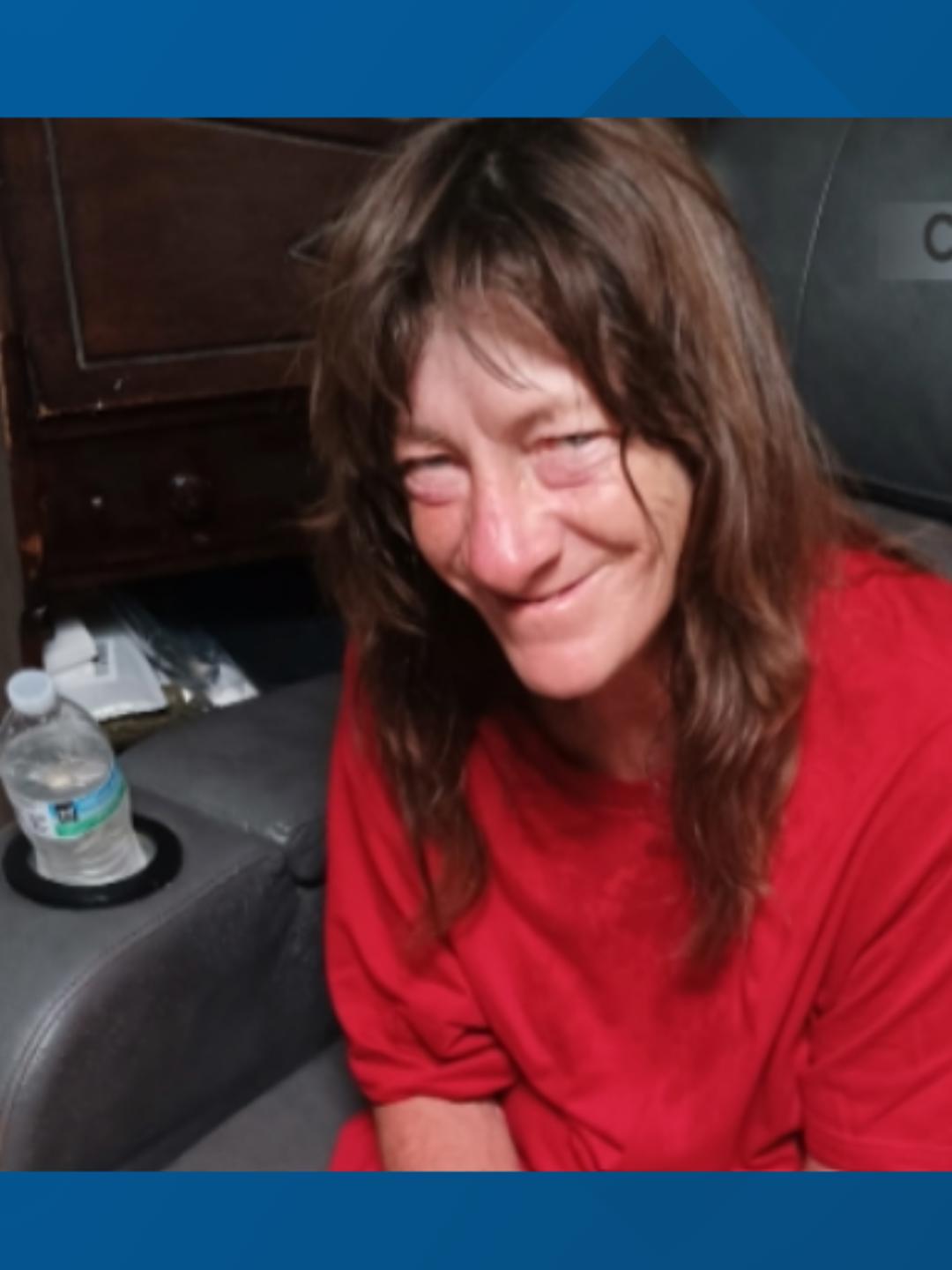Woman in wheelchair hospitalized after hit by car in Arizona | 12news.com