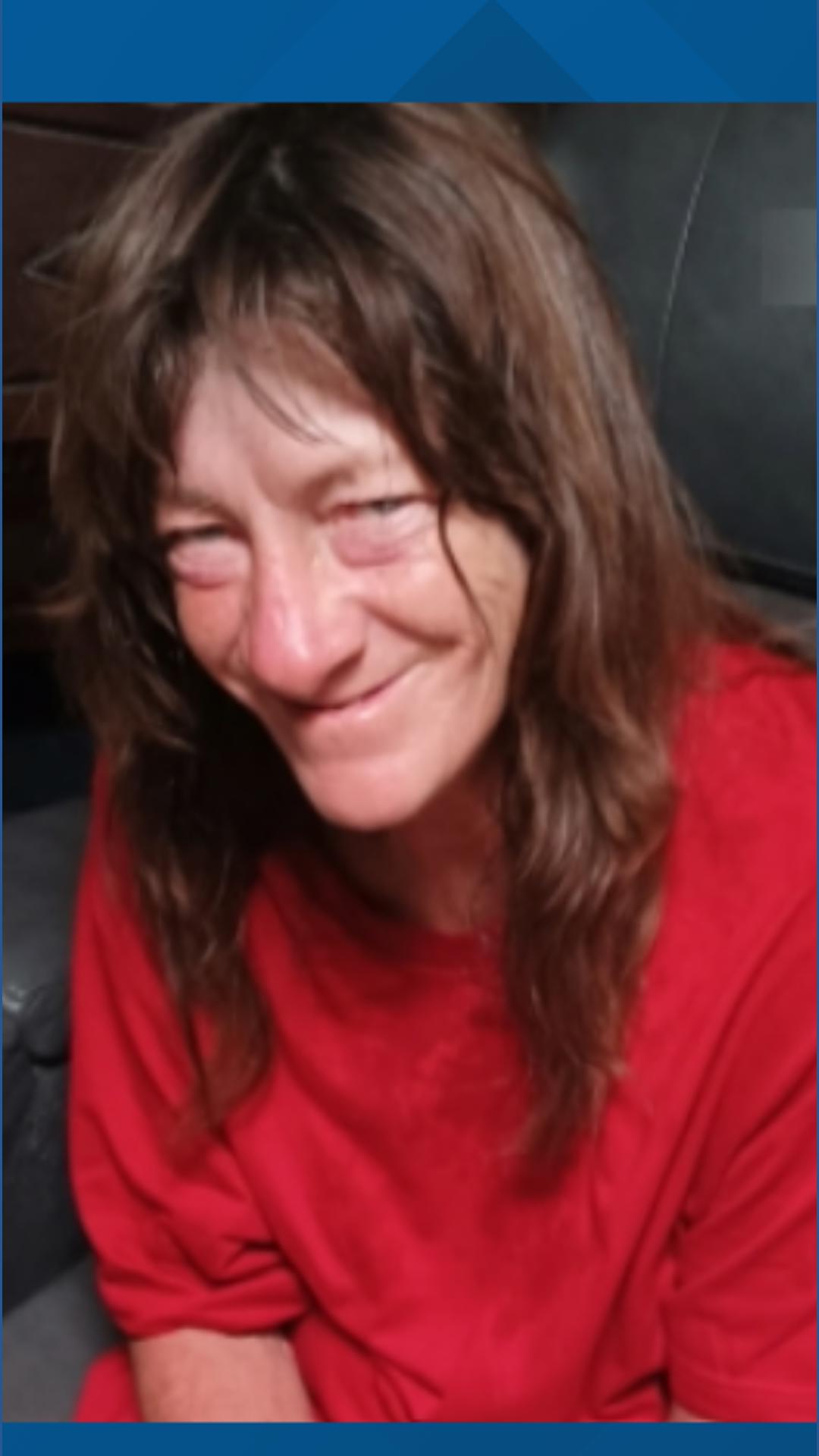 Woman in wheelchair hospitalized after hit by car in Arizona | 12news.com