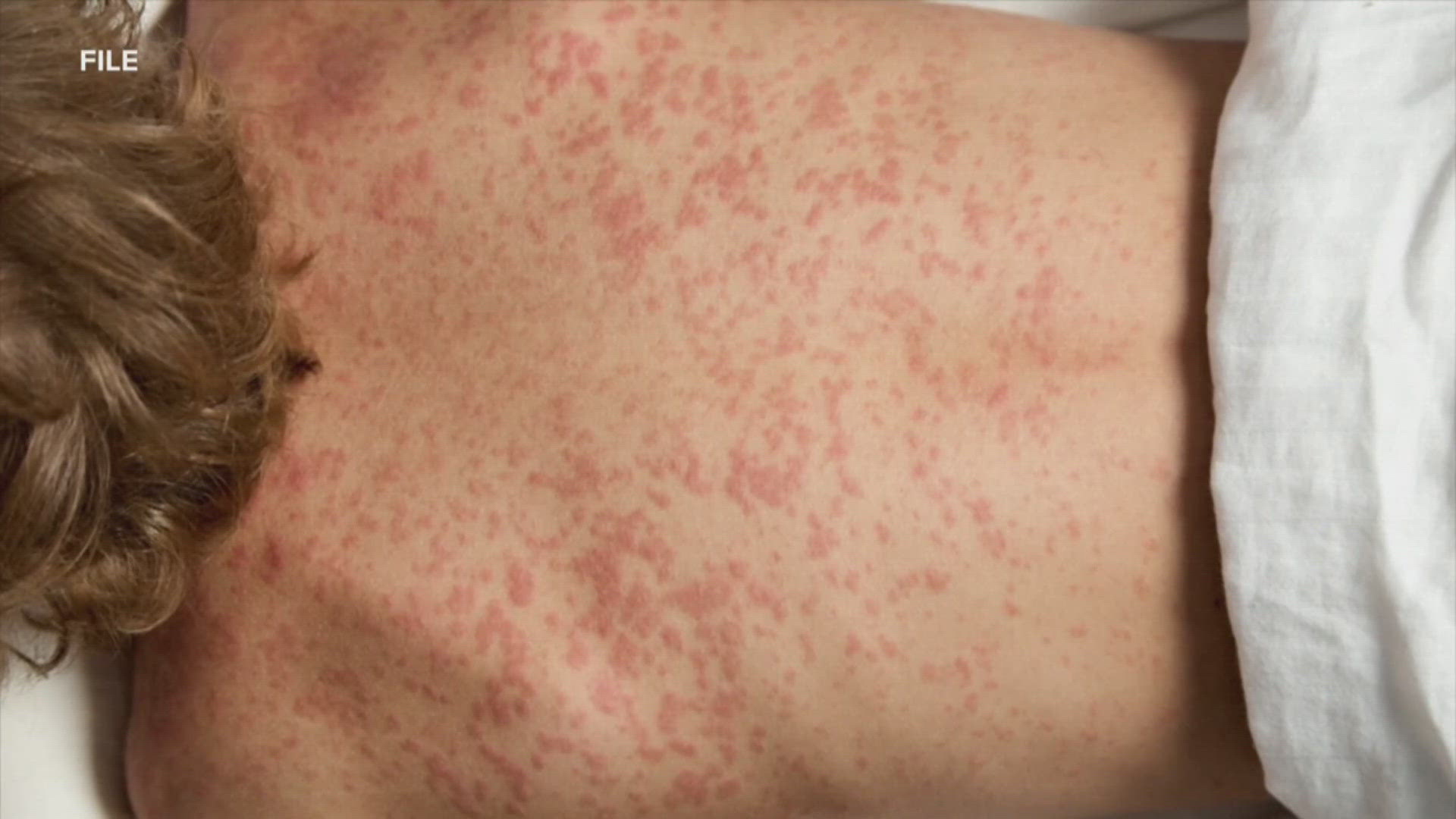 This Winter Olympics sport was once part of the Summer Games | 12news.com