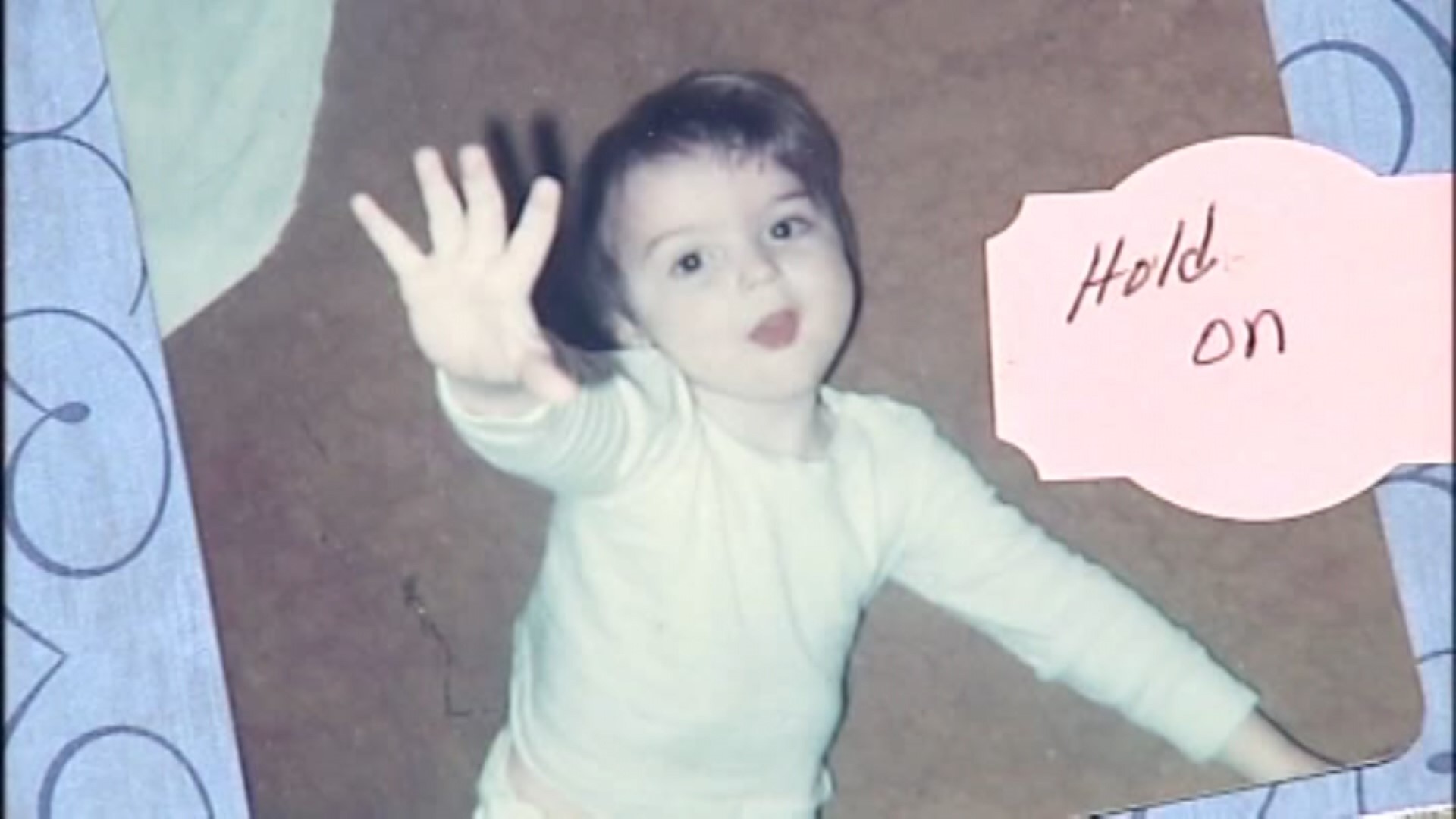 After surviving first-ever face transplant, man needs another medical ...