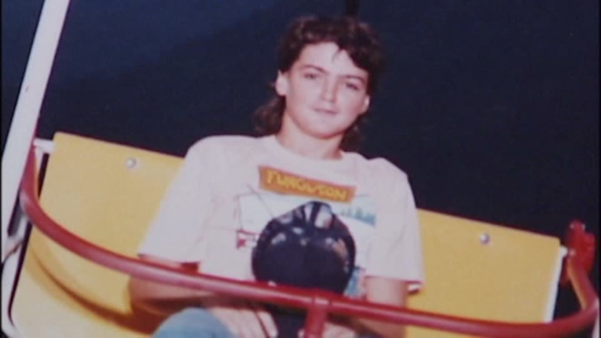 After surviving first-ever face transplant, man needs another medical ...