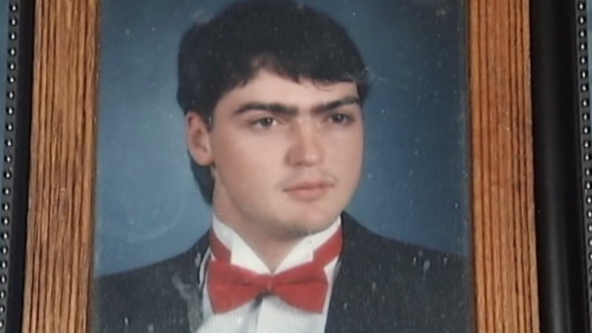 After surviving first-ever face transplant, man needs another medical ...